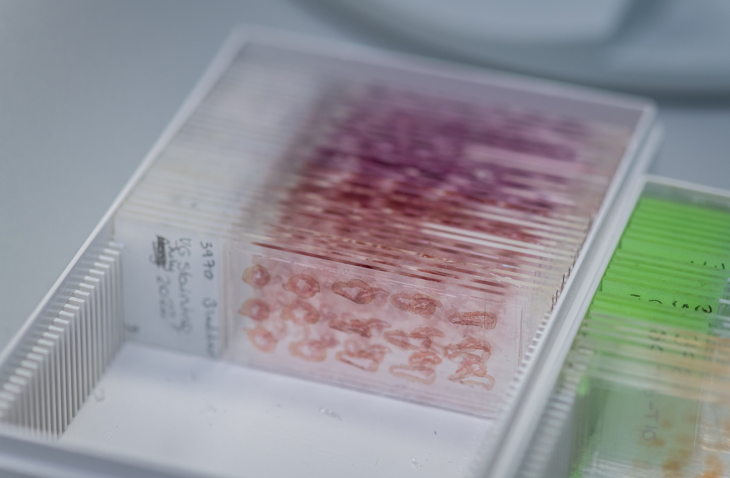 Clinical trial FAQs - Spinal Research